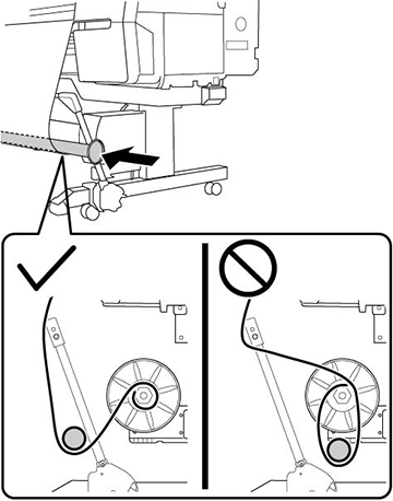 Assembling and Using the Tensioner